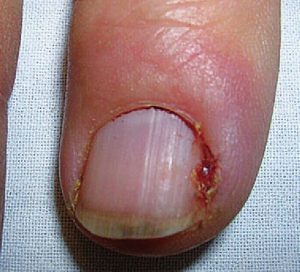 Periocular - Definition of Periocular