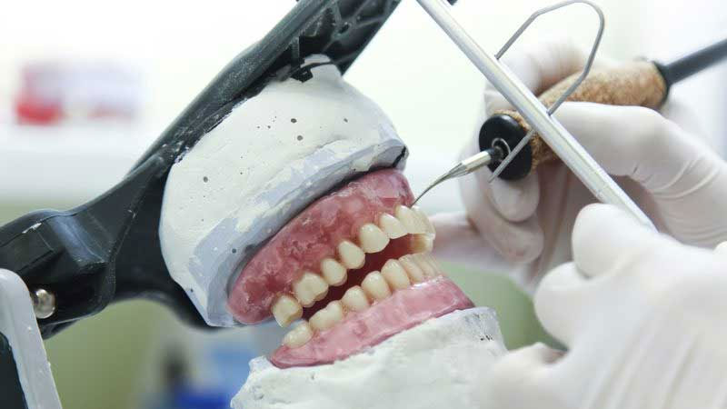 Dental technician - Definition of Dental technician