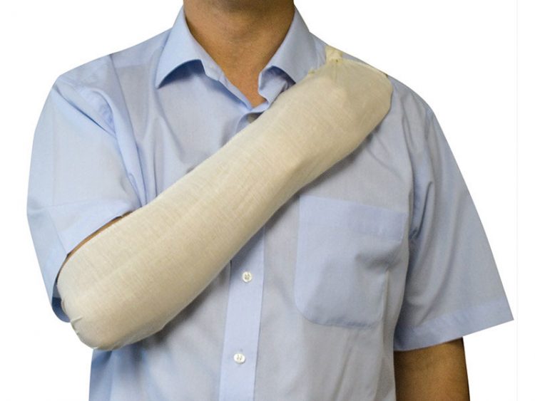 Elevation sling - Definition of Elevation sling