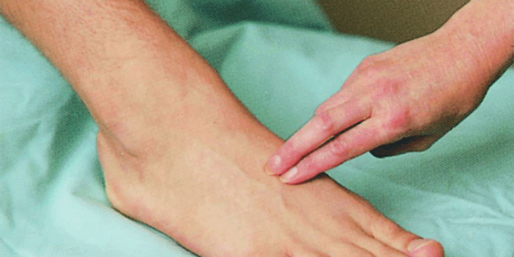Dorsalis Pedis Perfusion
