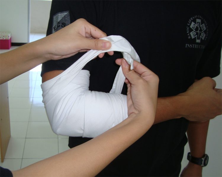 Cravat elbow bandage - Definition of Cravat elbow bandage